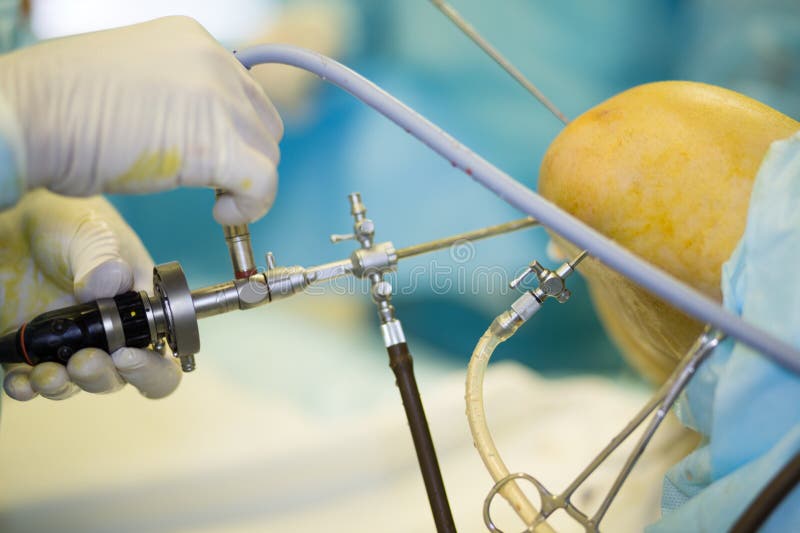 Doctor is Doing Drainage in Knee at the Center of Stock Photo - Image ...