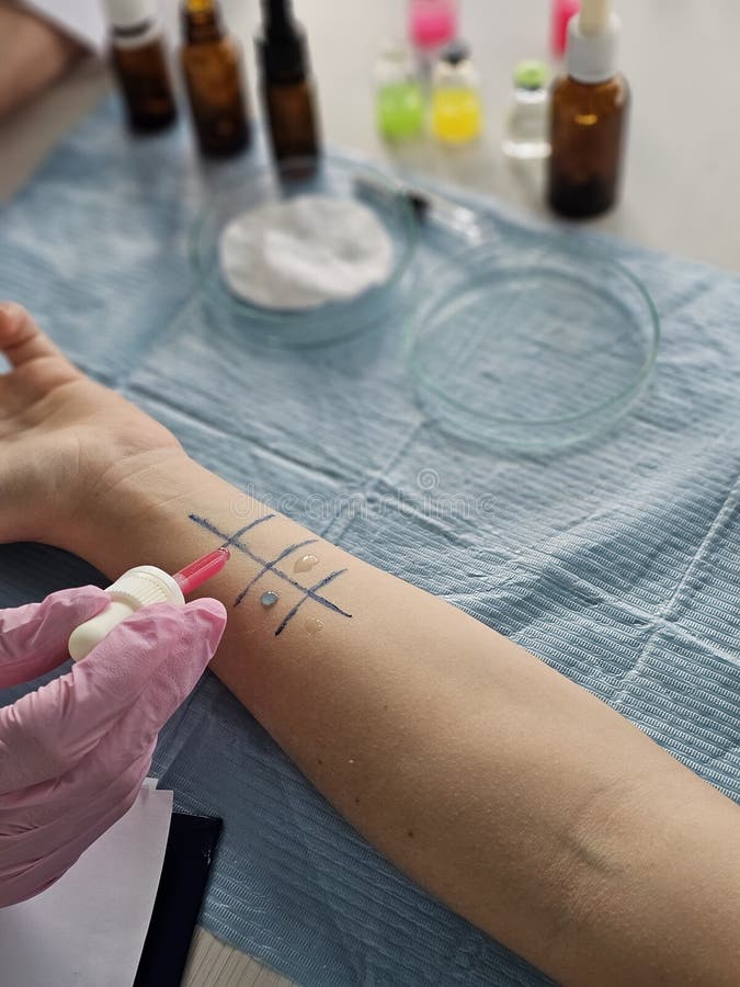 Doctor Doing Skin Allergy Test Closeup Stock Image - Image of ...