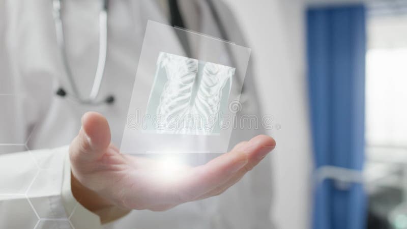 Doctor Analyzing Chest X-ray AI Stock Video - Video of intelligence ... Doctor Analyzing Chest X-ray AI Stock Video - Video of intelligence ...