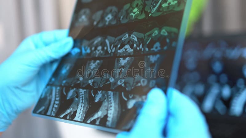 A Doctor Examines a Computed Tomography Scan of the Thyroid Gland on a ...