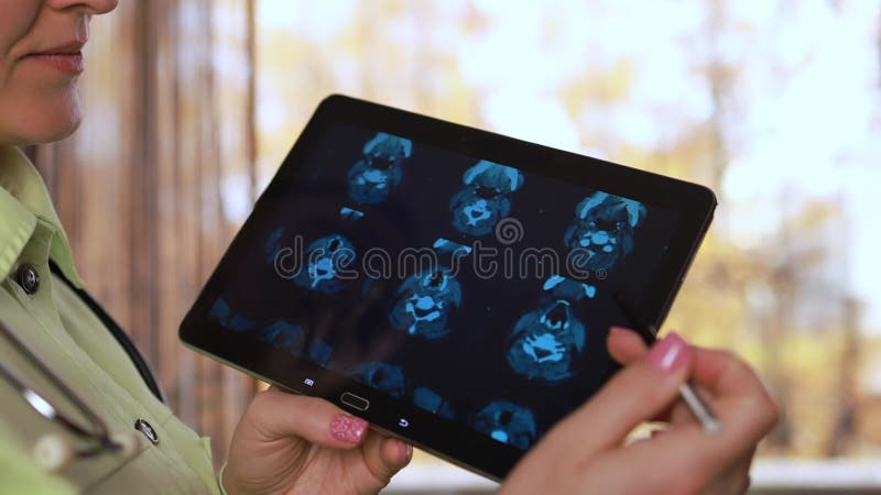 A Doctor Examines a Computed Tomography Scan of the Thyroid Gland on a ...