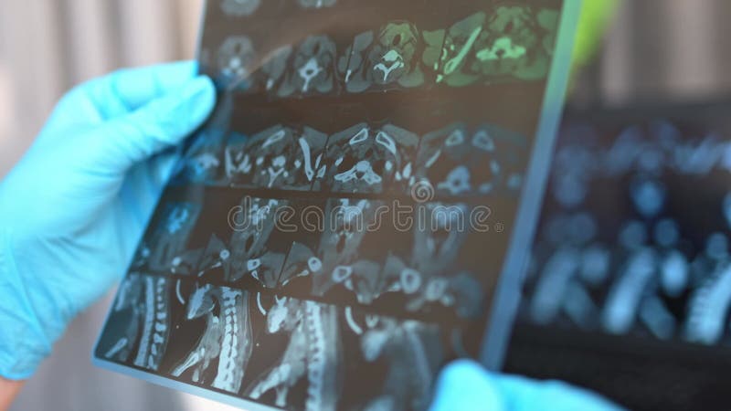 A Doctor Examines a Computed Tomography Scan of the Thyroid Gland on a ...