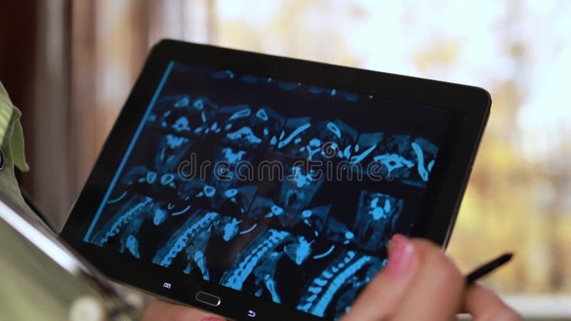 A Doctor Examines a Computed Tomography Scan of the Thyroid Gland on a ...