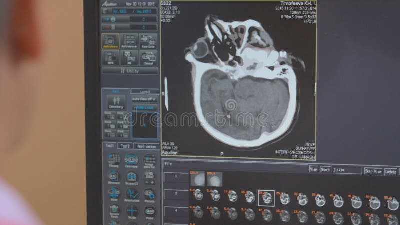 Head MRI Scan from Different Angles Stock Footage - Video of face ...