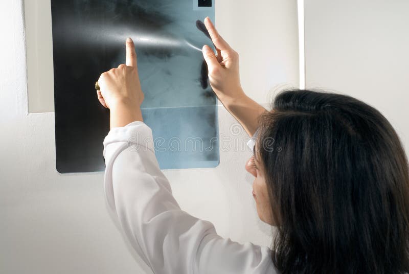 Doctor Examines an X-ray-Horizontal Stock Image - Image of indoor ...