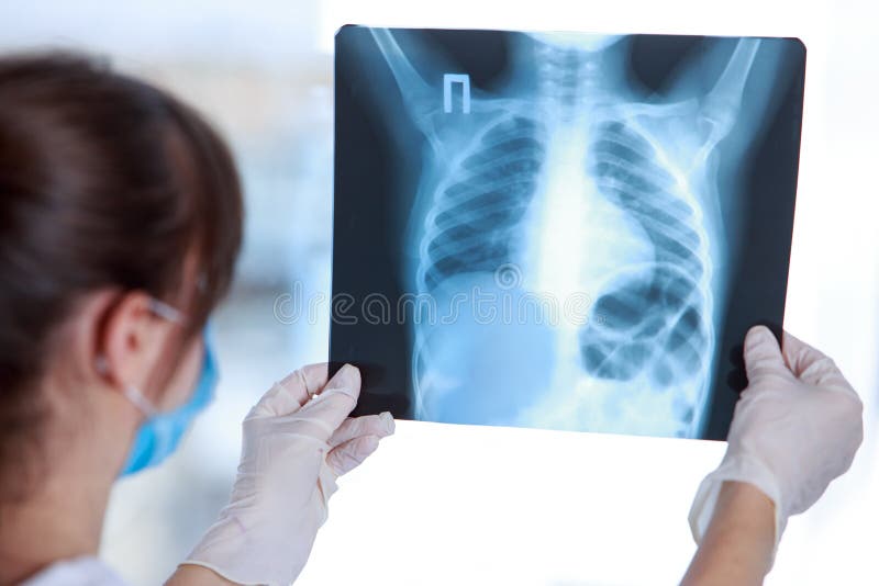 Doctor examines an X-ray stock photo. Image of child - 179693510