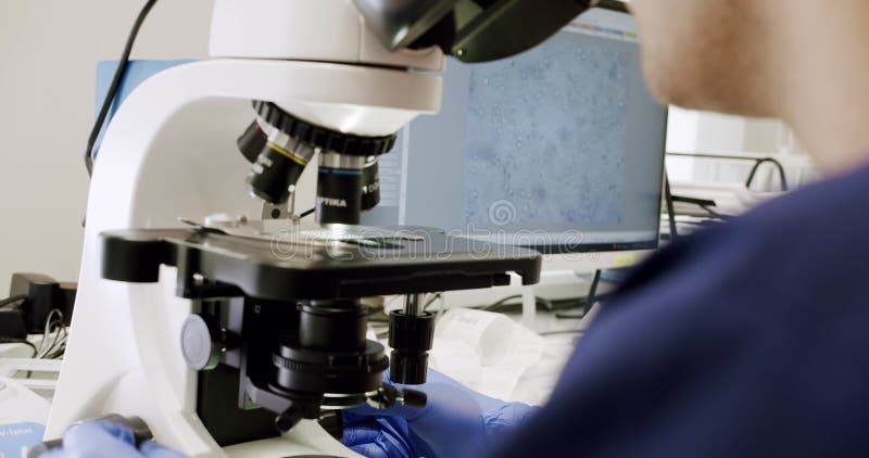 The Doctor Examines the Sperm Samples Under a Microscope. Stock Footage ...