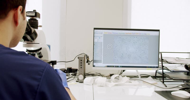 The Doctor Examines the Sperm Samples Under a Microscope. Stock Footage ...