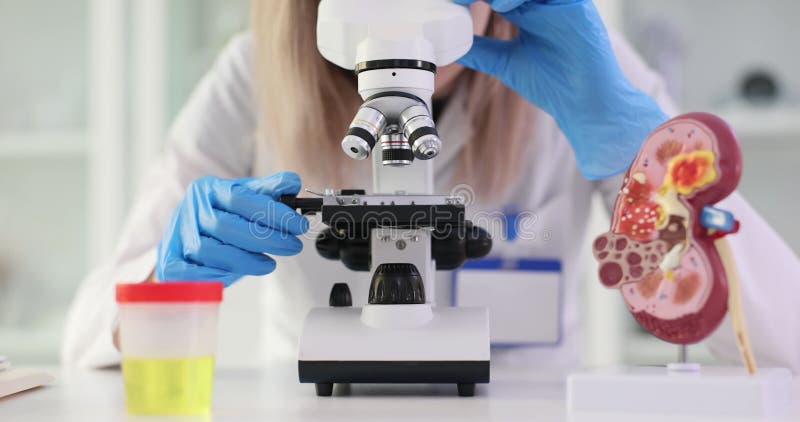 Doctor Examines Urine Test in Laboratory Stock Video - Video of ...