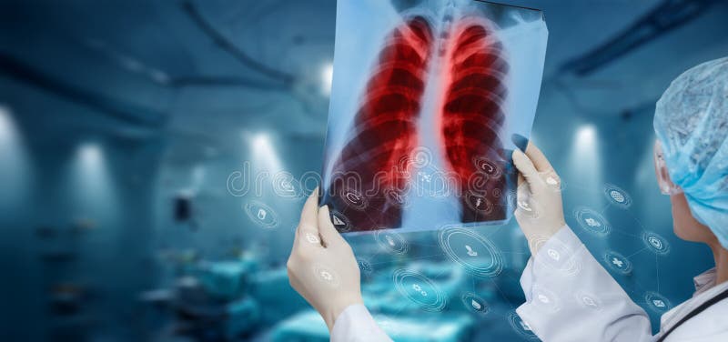 Doctor Examining a Snapshot of the Lungs in the Office Stock Image ...