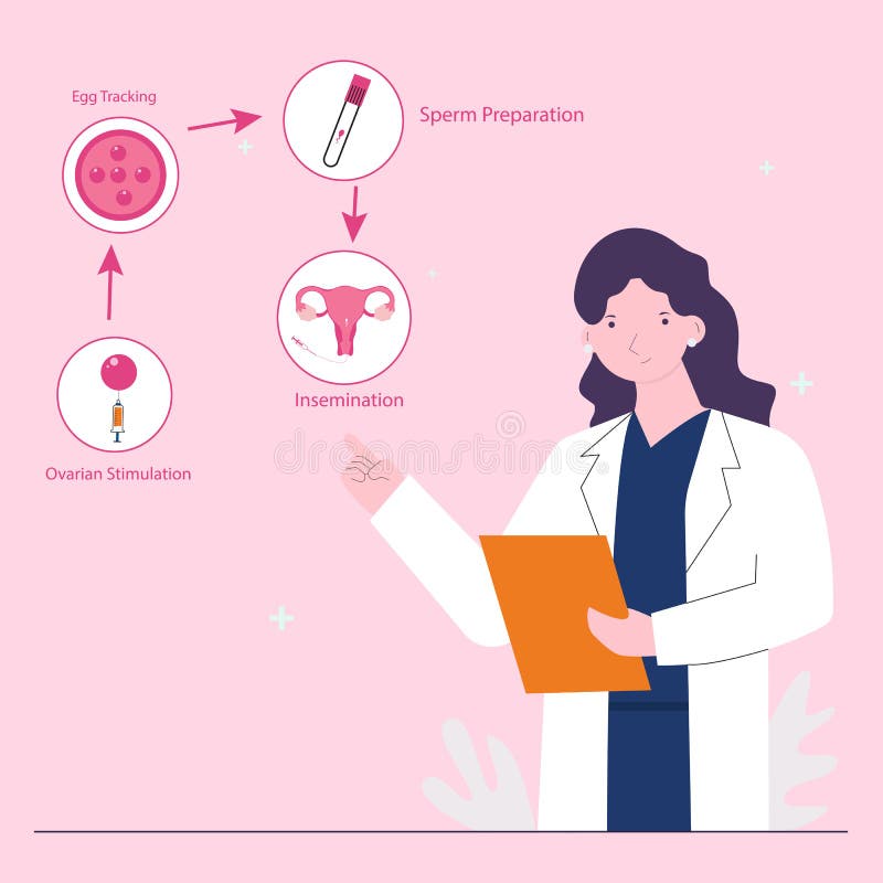 Doctor Explaining Intrauterine Insemination or IUI Stock Vector ...