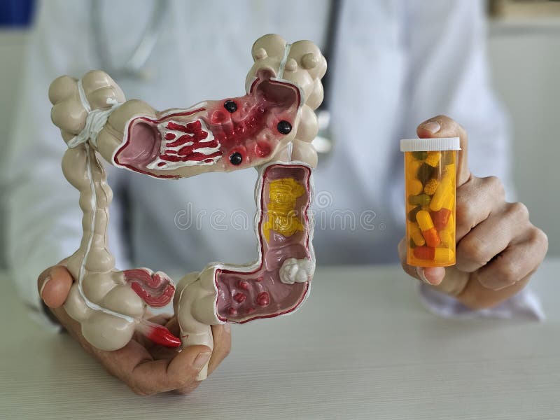 A Doctor Explains the Digestive System Using a Model and Holding a ...