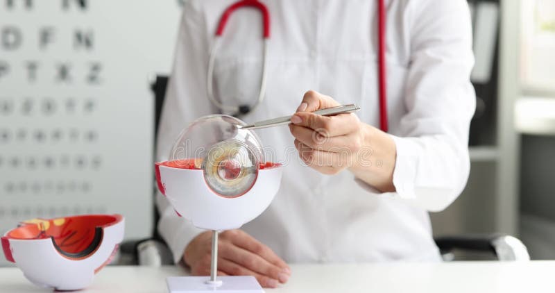 Doctor Explains Eyeball Structure Pointing Pen at Model Stock Video ...