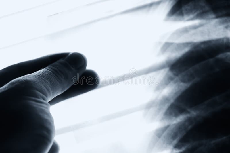 Doctor hand stock image. Image of xray, diagnosis, care - 22218363