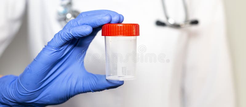 Sperm In Urine Sample