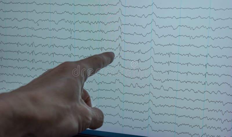 Doctor Hand Pointing at EEG Graph on Computer Screen Stock Image ...