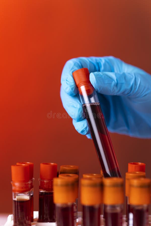 Doctor Hand Taking a Blood Sample Tube from a Rack Stock Image - Image ...