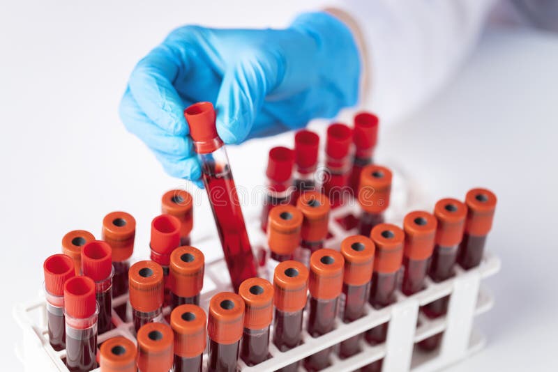 Doctor Hand Taking a Blood Sample Tube Stock Photo - Image of data ...