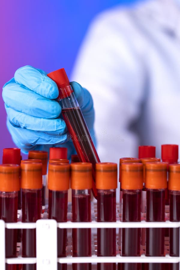Doctor Hand Taking a Blood Sample Tube from a Rack Stock Photo - Image ...