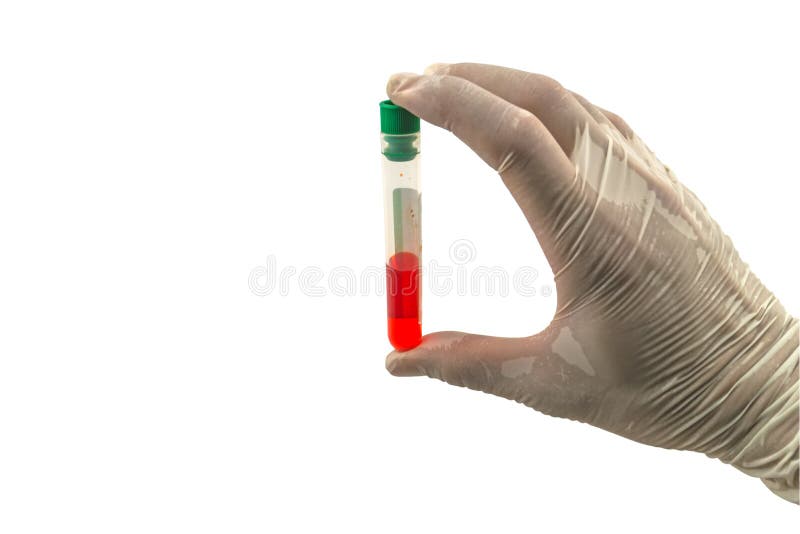 A Bottle of Blood Sample on Medical Report Stock Image - Image of ...