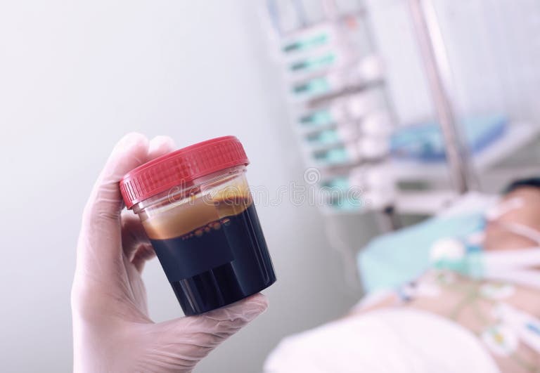 Doctor Holding Container in the Patient S Room Stock Image - Image of ...