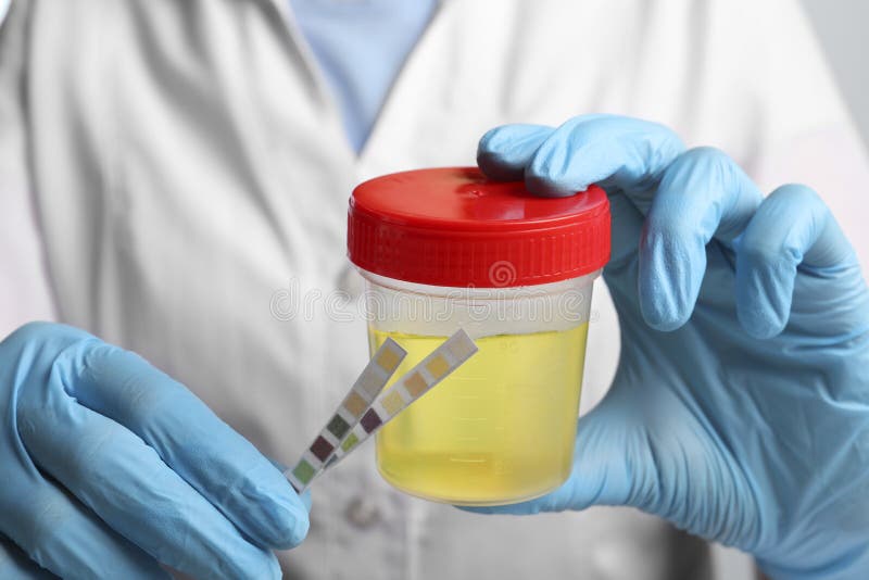 Doctor Holding Container with Urine Sample and Test Strips for Analysis ...