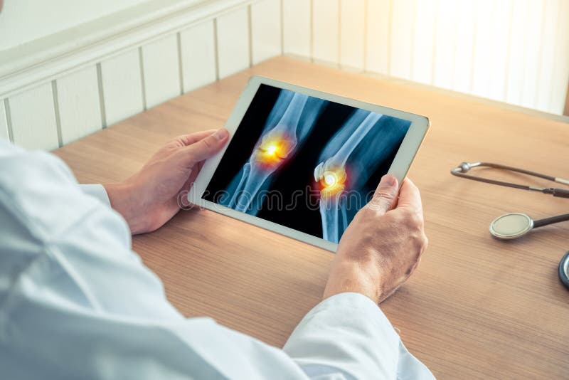 Doctor Holding a Digital Tablet with X-ray of Legs with Pain on the ...