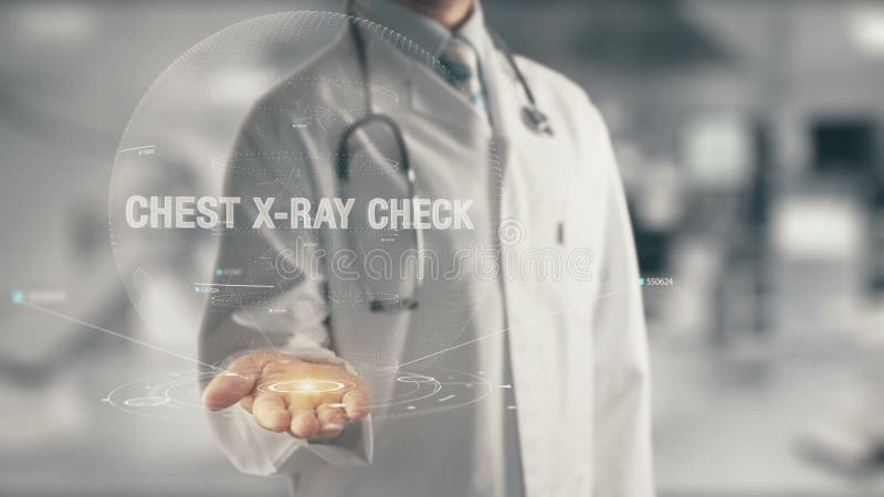 Doctor Holding in Hand Chest X-ray Check Stock Image - Image of holding ...