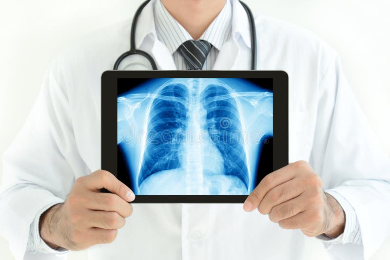 Doctor Holding Tablet Pc with Normal Male Chest X-ray Image Stock Image ...