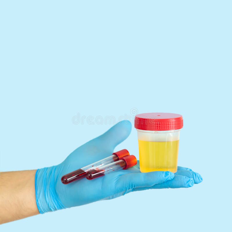Urine and Blood Test (complete Blood Count) Stock Photo - Image of ...