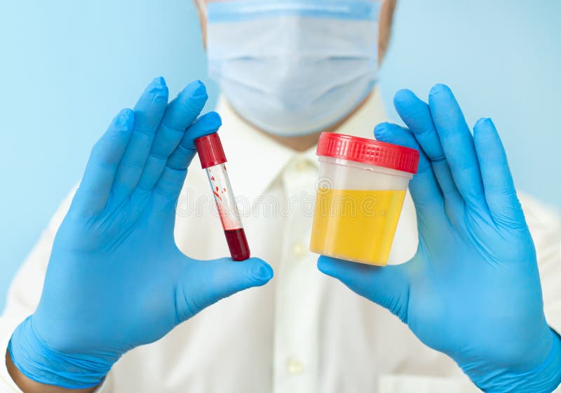 Urine And Blood Test (complete Blood Count) Stock Image - Image of ...