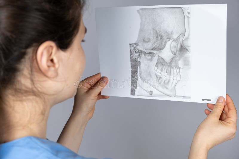 The Doctor Holds a CT Scan of a Patient with Temporomandibular Joint ...
