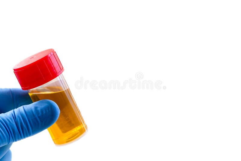 Doctor`s Holds Blood Sample and Urine Sample: for Test and Analysis on ...