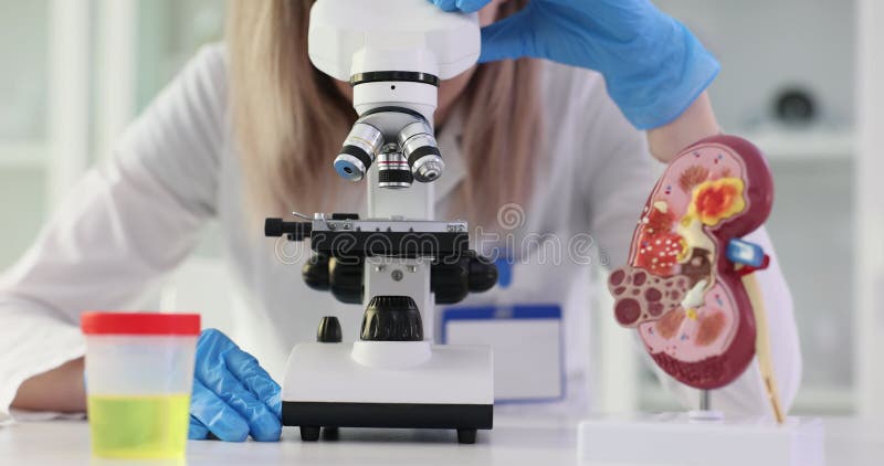 Doctor Laboratory Technician Examines Kidney Urine Sample Under ...