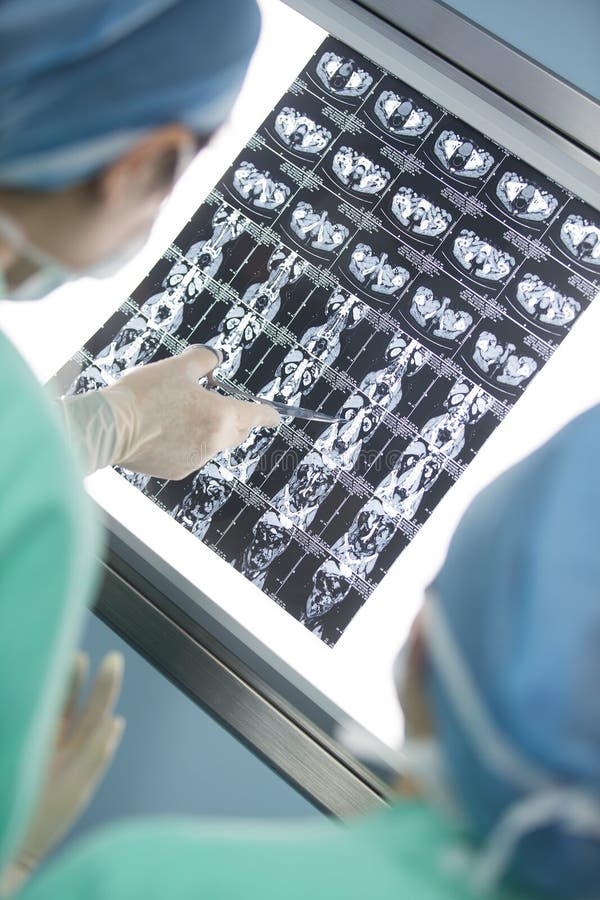 Doctor looking at ct scan. stock photo. Image of adult - 174102100