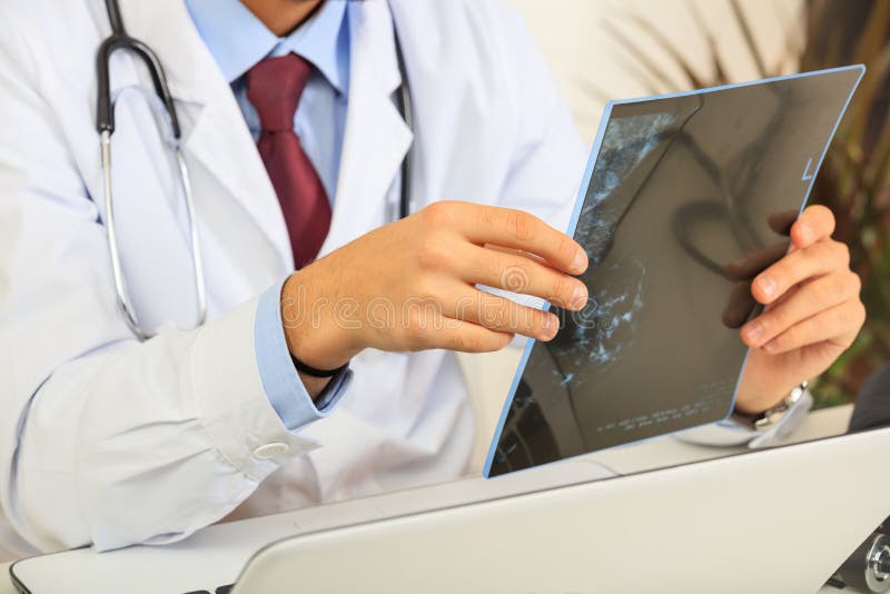 Doctor Looking at a Mammography Stock Photo - Image of holding, care ...