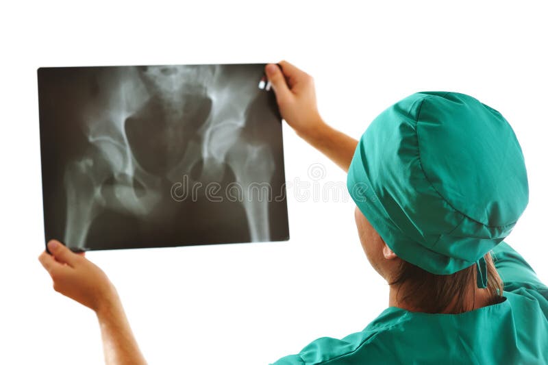 Doctor check X-ray picture stock photo. Image of illness - 4613684