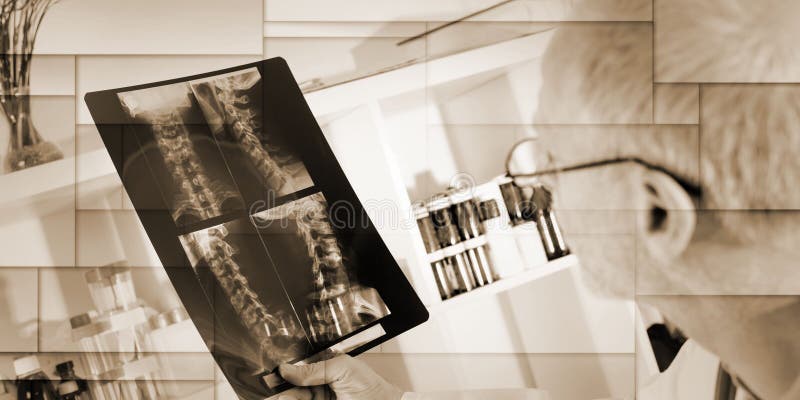 Doctor Looking at a X-ray Radiography, Geometric Pattern Stock ...