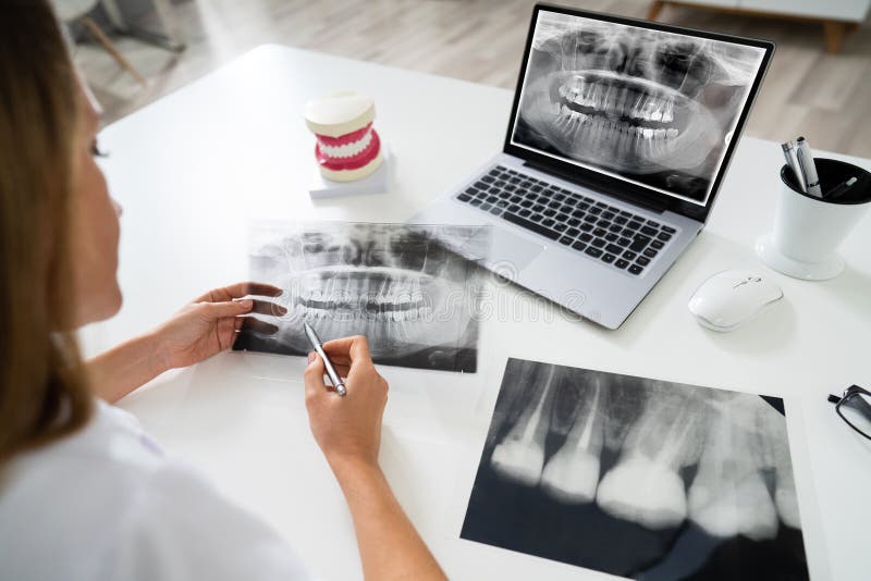Doctor Looking at Teeth X-ray on Computer Stock Photo - Image of women ...