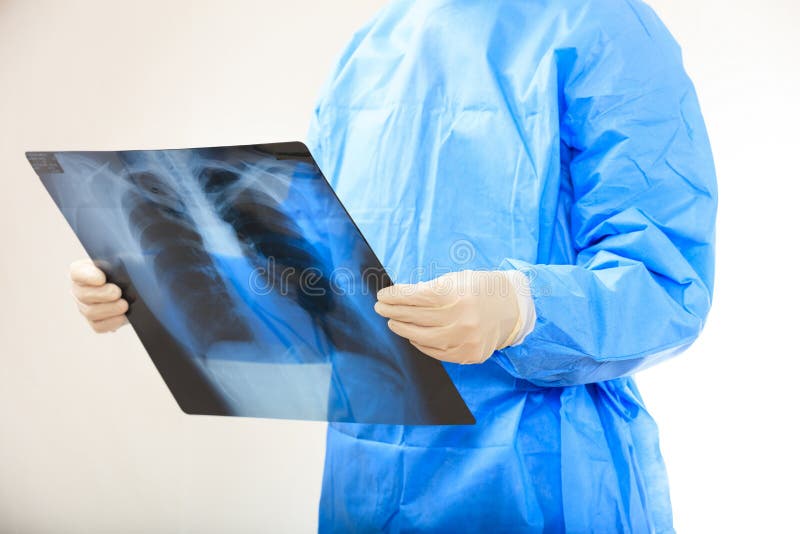 Doctor looking at xrays stock photo. Image of isolated - 81856084