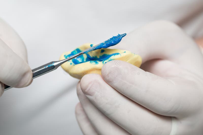 Doctor Makes a Plastic Prosthetic Dentistry Stock Photo - Image of ...