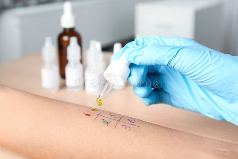 Doctor Making Allergy Test At Table Stock Image - Image of drop, adult ...