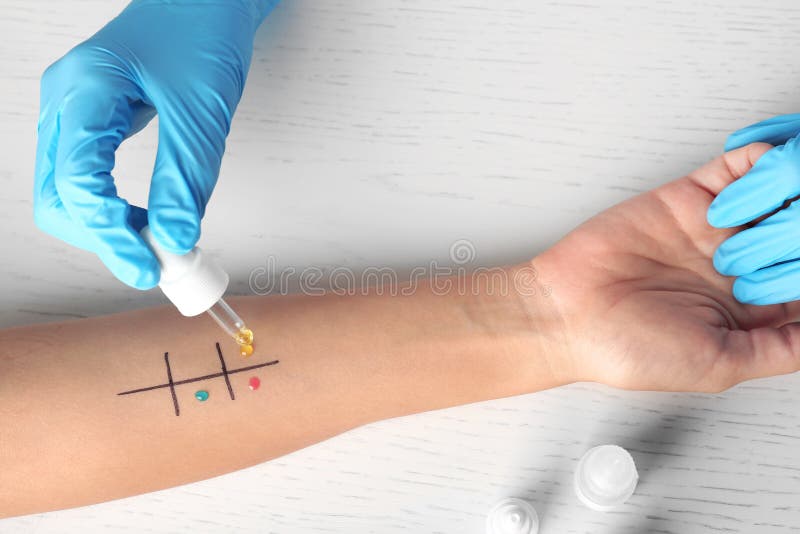 Doctor Making Allergy Test at Table Stock Image - Image of hand ...