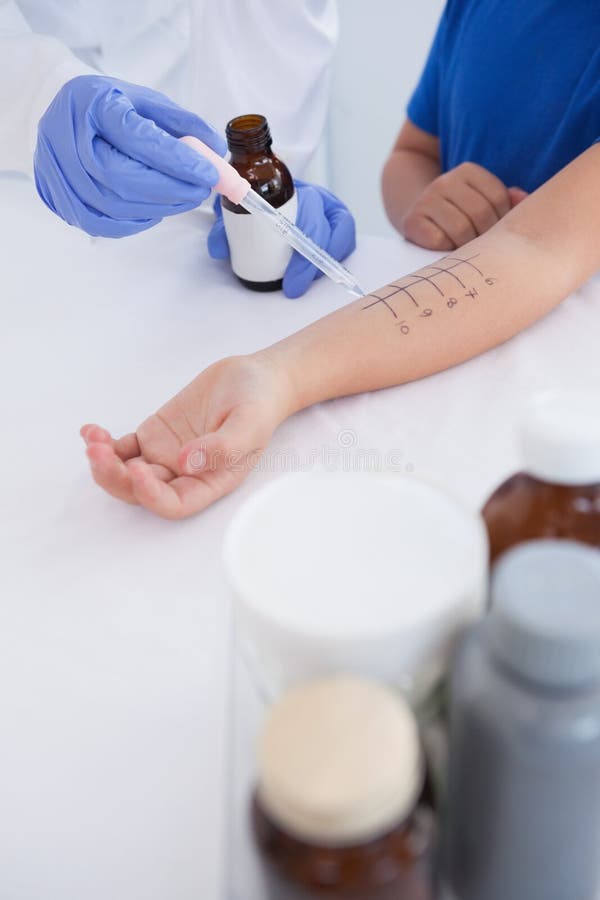 Doctor Performing a Skin Test Stock Photo - Image of people, clinic ...