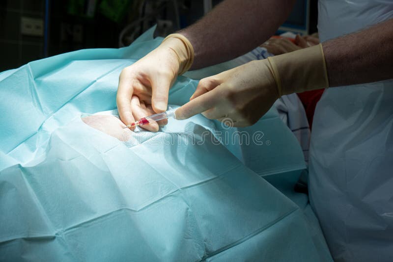Doctor Performs a Knee Puncture in an Operating Room with a Cannula and ...