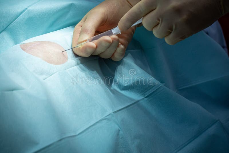 Doctor Performs a Knee Puncture in an Operating Room with a Cannula and ...