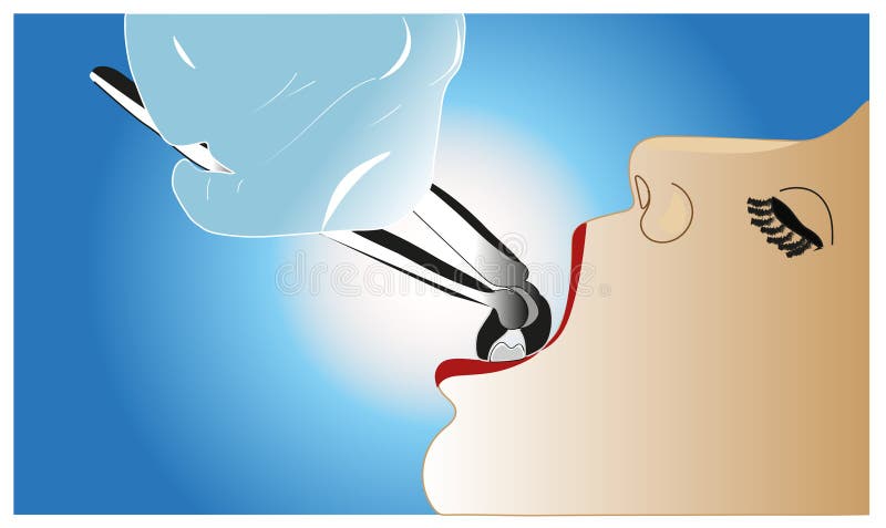 Doctor Pulling a Man S Tooth Stock Vector - Illustration of poster ...