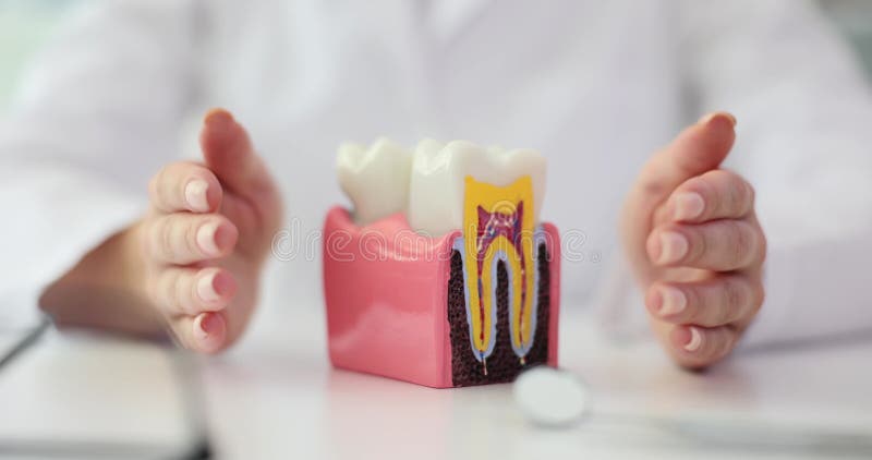 Doctor Puts Hands on Sides of Tooth Artificial Model on Table Stock ...
