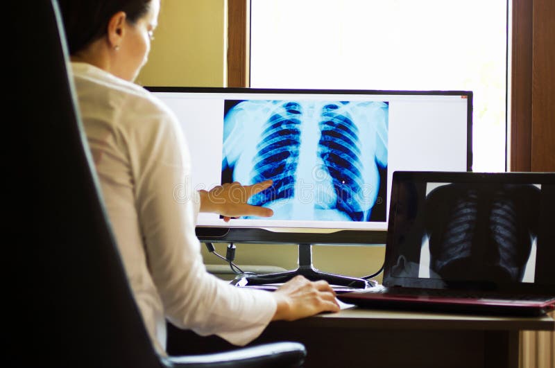 Doctor Radiographer Looking at X Ray on Computer Screen Stock Photo ...