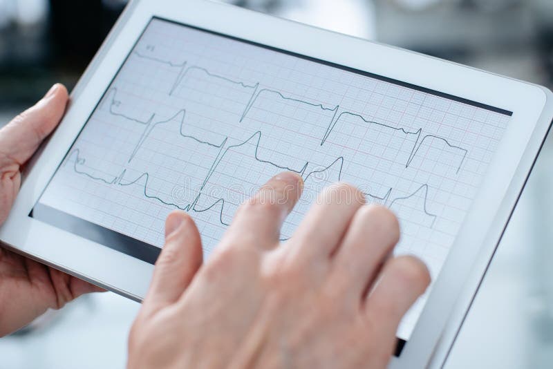 Doctor Reading a Cardiogram on the Screen of a Digital Tablet. Stock ...